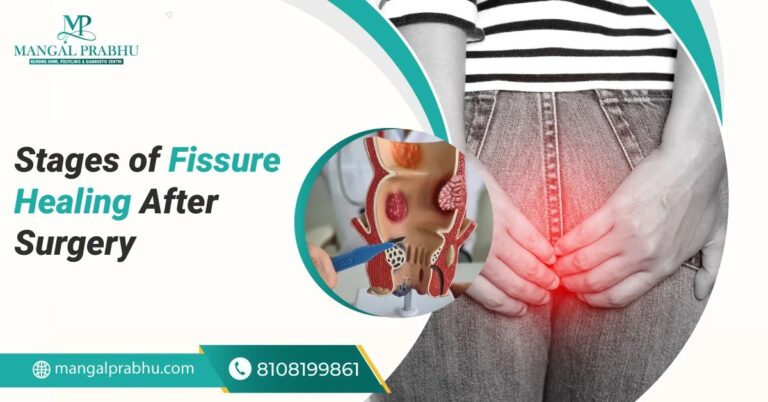 Stages Of Fissure Healing After Surgery 9936