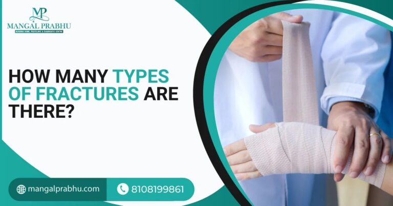 How Many Types of Fractures Are There?