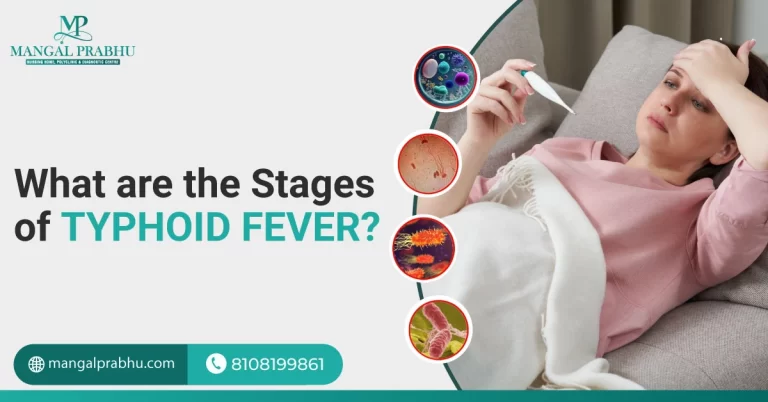 What are the Stages of Typhoid Fever?